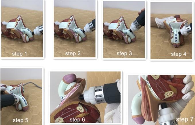 Shockwave Therapy Machine /Extracorporeal Shockwave for peyronie’s disease