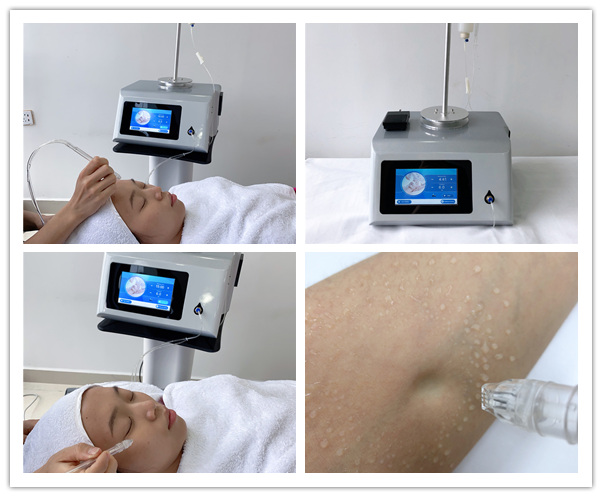Skin Rejuvenation Jet Peel Machine With 6 Bar Pressure