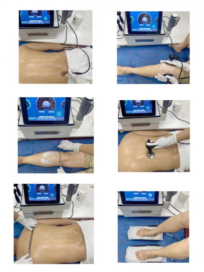 200MJ Ultrasound Therapy Machine Diathermy Radiofrequency Physiotherapy ...